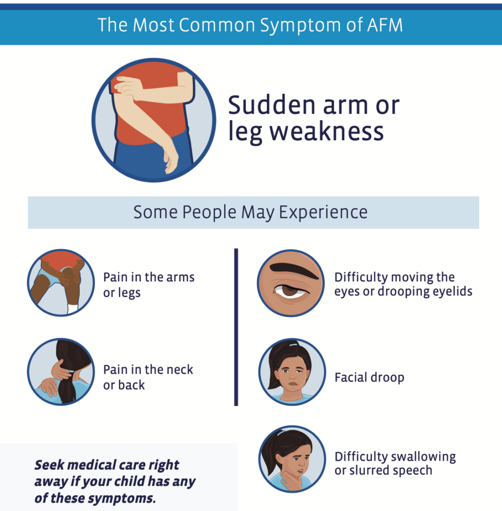 Acute Flaccid Paralysis (AFP)/ Acute flaccid myelitis (AFM) – EMbeds.co.uk