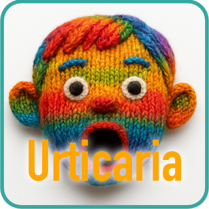 Urticaria – EMbeds.co.uk